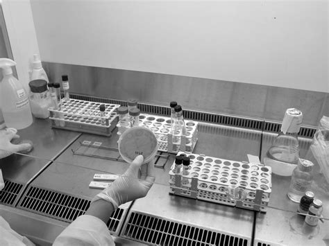 Promising Steps Towards Improving Tuberculosis Diagnostics And Treatment COST