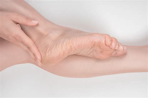 하얀 배경에 크림과 로션 풋 드라이어를 바르는 클로즈업 아름다운 젊은 여성 발가락과 발 뒤꿈치에 보습제 및 트리트먼트 코스메틱 스킨케어 화장품 및 건강 컨셉 인간 발에 대한