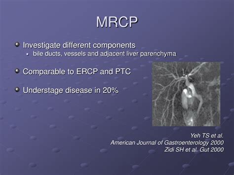 Ppt Cholangiocarcinoma East Vs West Management Discrepancies Powerpoint Presentation Id 9182272