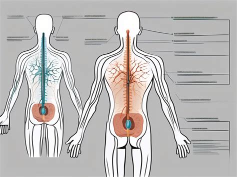 How High Sacral Nerve Stimulation Is Needed For Bladder Control