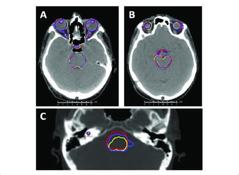 Ct Axial Scans Showing Examples Of The Predicted Ct Deep Learning