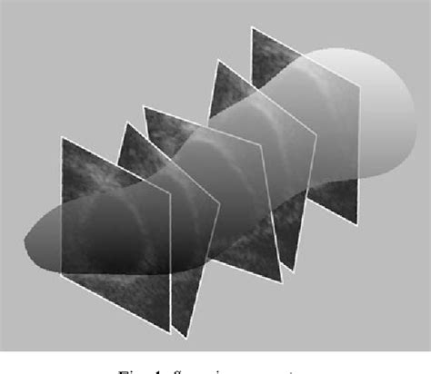Figure 1 From A Rayleigh Reconstructioninterpolation Algorithm For 3d Ultrasound Semantic Scholar