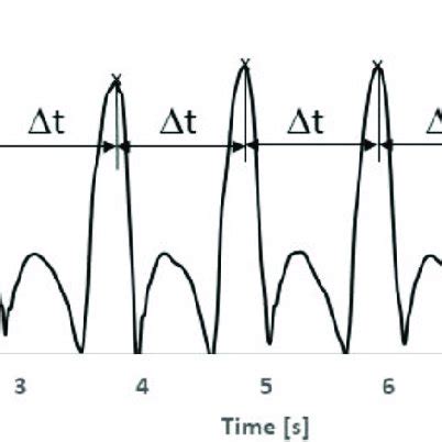 Typical Swing Angular Velocity Of A Leg Measured In The Sagittal Plane Download Scientific