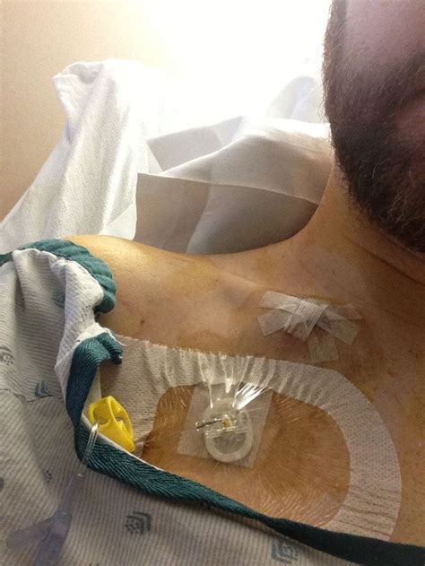 Chemotherapy With A Port Pictures