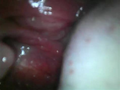 Endo Deep ThisVid Com