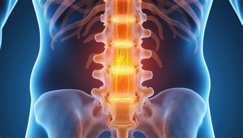 Understanding Nerve Root Compression Syndrome Symptoms Causes And