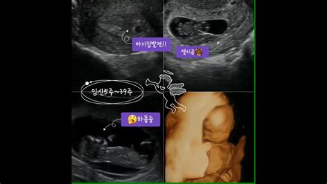 태아 초음파 영상 모음집 L 임신5주~임신39주 L 성장과정 L 성장일기 L 아기 발달과정 Youtube