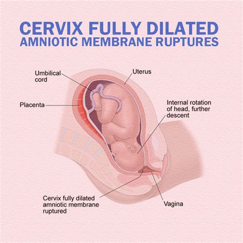 Pregnancy 📌 Cervix Dilation Short And Simple 🤰 🔸 Cervix Opens To