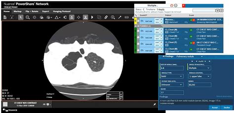 Precision Imaging Network For Ai Developers In Radiology Nuance