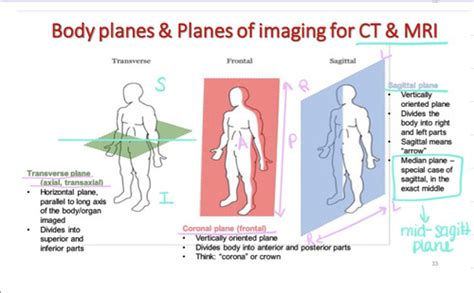 MRI Image Production Flashcards Quizlet