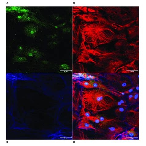 Confirmation Of Choroid Plexus Epithelial Cells Monolayers Of Cells Download Scientific