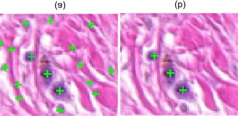 Nuclei Detection Results By The Technique In 21 A Results Before