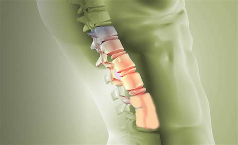 Lumbar Spine Meet Dr Joel Edionwe