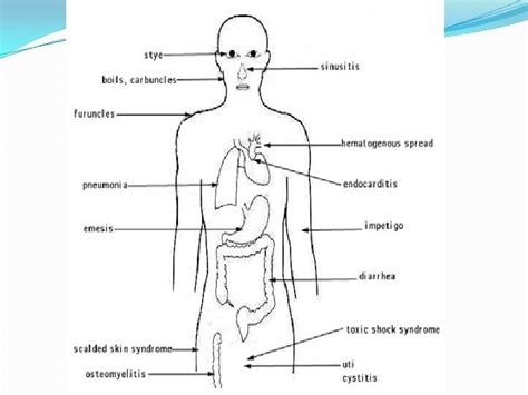 Staphylococci Introduction Staphylococci Are Grampositive Spherical Bacteria Arranged