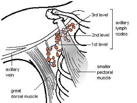 History Examination Of The Breast M K Alam