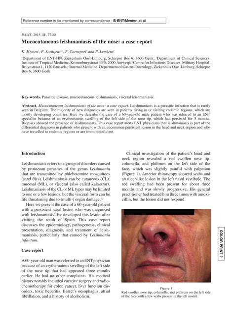 Pdf Mucocutaneous Leishmaniasis Of The Nose A Case Report Pdf Mucocutaneous Leishmaniasis Of The Nose A Case Report