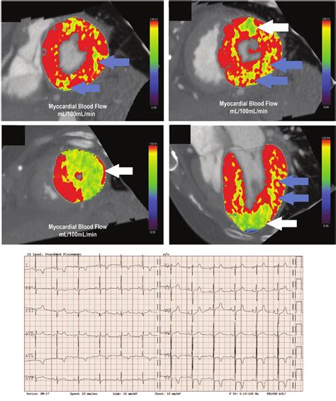 Computed Tomography Perfusion And Electrocardiography A D Dynamic Download Scientific Diagram