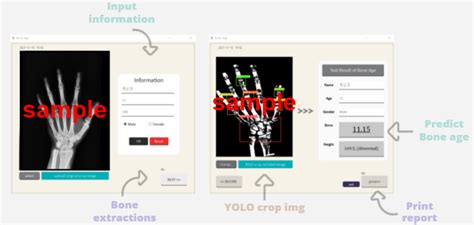 Bone Detection Kikiru Bone Detection GitHub Wiki