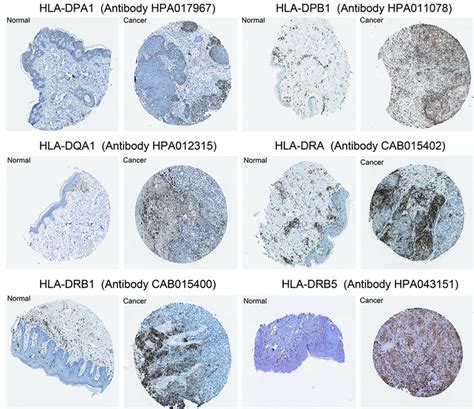 Validation Of Protein Expression Levels Of Hub Genes In The HPA Database Download Scientific