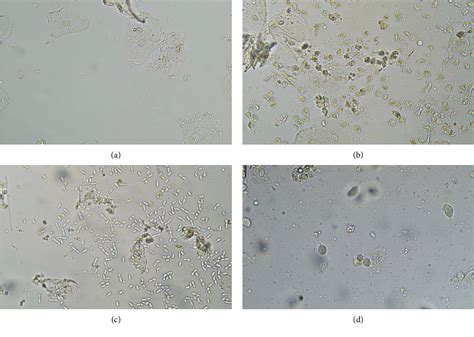 Figure 1 From A Data Efficient Framework For The Identification Of Vaginitis Based On Deep