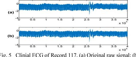 Figure 1 From Energy Efficient Ecg Compression In Wearable Body Sensor Network By Leveraging