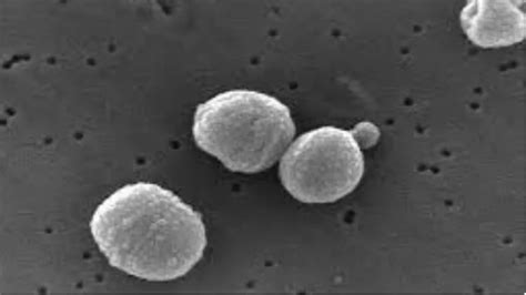 Segundo Caso De Meningite Bacteriana é Confirmado Em Cidade Brasileira