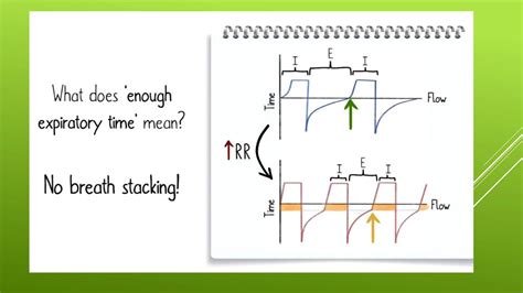 Ventilator Troubleshooting In Icu Hospitalpptx