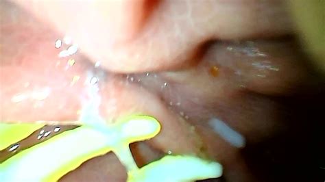 Cm Rubber Centipedes Inside My Stomach Thisvid Com