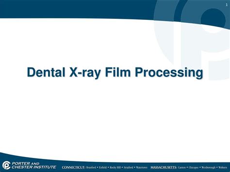 Ppt Dental X Ray Film Processing Powerpoint Presentation Free