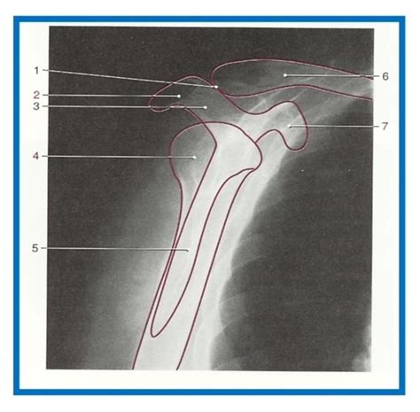 Scapular Y Lateral X Ray Diagram Quizlet