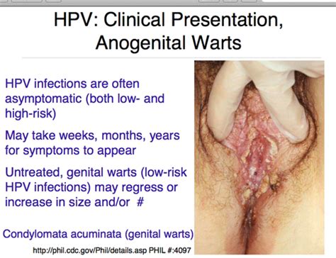 Overview Of STDs Flashcards Quizlet