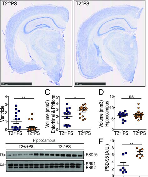 Trem2 Deficiency Attenuates Neurodegeneration In Ps19 Mice A Download Scientific Diagram