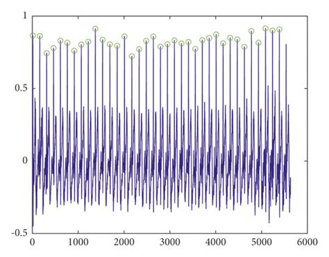 R Wave Diagram Of The Localized Ecg Signal Download Scientific Diagram