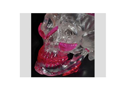 Custom Facial Implants Dr Barry Eppley Indianapolis Explore Plastic
