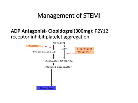 St Segment Elevation Myocardial Infarctionpptx Heart And Cardiovascular Diseases Diseases