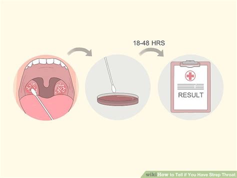 How To Tell If You Have Strep Throat With Pictures WikiHow