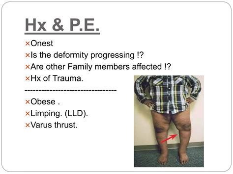 Physiological And Pathological Tibia Vara Ppt