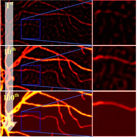 Accelerated Model‐based Iterative Reconstruction Strategy For Sparse‐view Photoacoustic