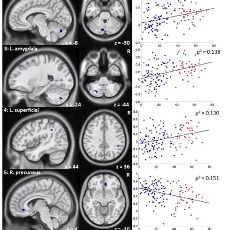 differences in the average functional connectivity maps of left