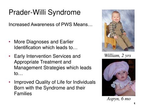 Ppt Prader Willi Syndrome Powerpoint Presentation Free Download Id 362863