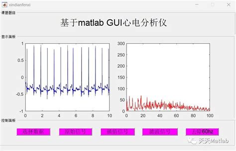 【心电信号】基于matlab实现心电信号分析基于matlab的心电信号的分析与处理设计 Csdn博客