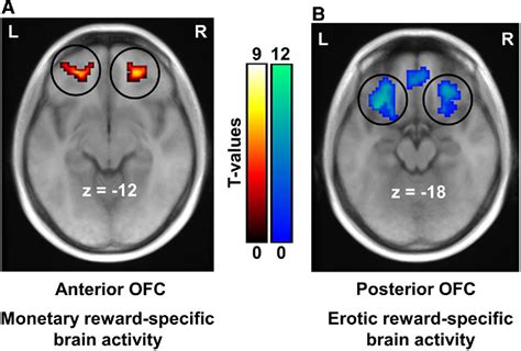 Figure 3 From Local Morphology Predicts Functional Organization Of