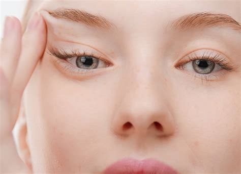 Brow Lift Before And After Photos And What It Felt Like Realself News