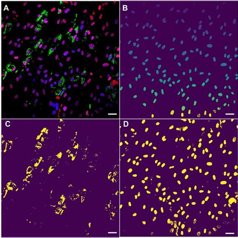 Python Generated Images Depicting Masks For Computer Assisted Analysis Download Scientific