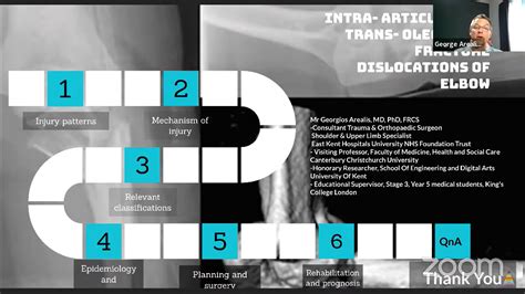Trans Olecranon Fracture Dislocations —