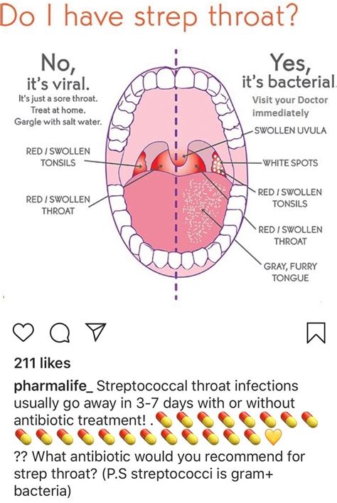 Pin By Sarah Johnston On Health Strep Throat Throat Infection