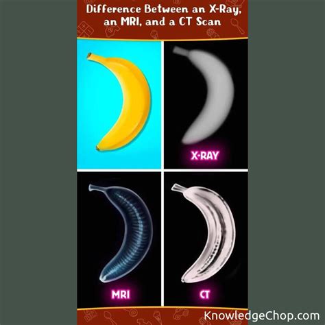 Guide To The Differences In Medical Scanning Devices 🥷 Knowledge Ninja