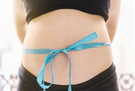 C Section Cesarean Birth Phivio