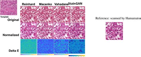 Figure 2 From Characterization Of Color Normalization Methods In Digital Pathology Whole Slide