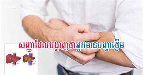 សញ្ញា ដំបូង ដែល បង្ហាញ ថា អ្នក មាន បញ្ហា ថ្លើម